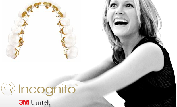 Services - NuSmiles Orthodontics